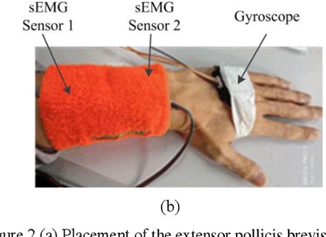 Figure 2 From A Self Selected Movement Classification Method For Forearm Via Semg And Attitude
