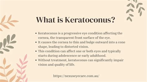 Understanding Corneal Cross Linking For Keratoconuspdf