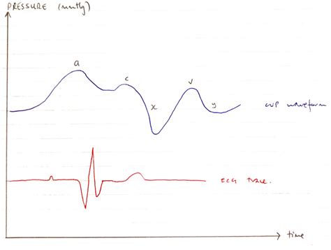 G3ii 21a05 19b06 Outline The Factors That Determine Cvp And Explain How It Is Measured