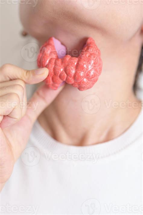Woman Holding Human Thyroid Anatomy Model With Her Neck Hyperthyroidism Hypothyroidism