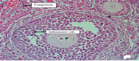 Photomicrograph Section Of The Ovary Which Showed Infiltrations Of Download Scientific Diagram