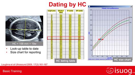 Lecture 10 Fetal Biometry Dating Assessing Size Estimating Fetal Weight Pdf
