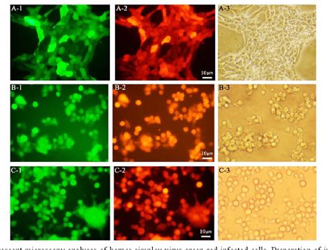 Figure 3 From Cytotoxic Effect Of Dual Fluorescent Labeled Oncolytic Herpes Simplex Virus Type 1