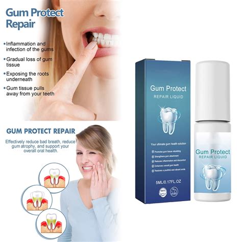 Musatteng Gingival Cleaning Of Stains And Yellowing And Of Teeth Oral