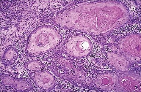Pin On Histopathology