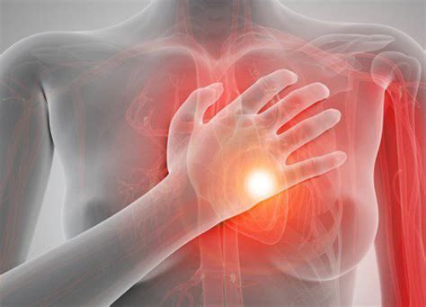 Los Signos De Ataque Al Corazón Son Diferentes En Las Mujeres