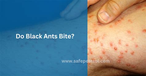 Do Black Ants Bite 5 Shocking Facts You Didnt Know