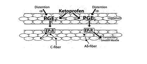 Ketoprofen Patented Technology Retrieval Search Results Eureka Patsnap