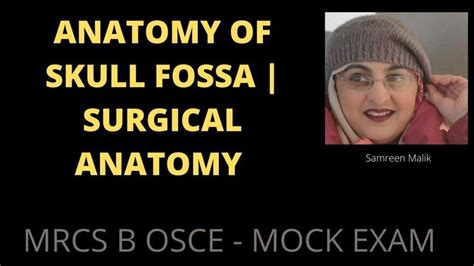 Anatomy Of Skull Fossa Surgical Anatomy Communication Skills