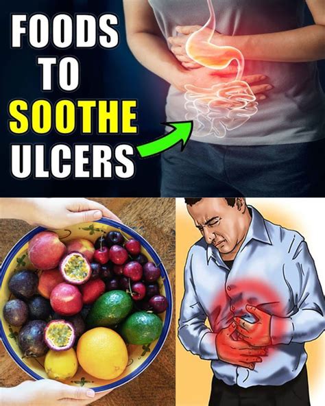 Top 10 Foods To Heal Stomach Ulcers Naturally