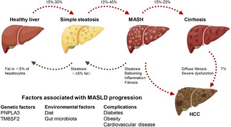 Unmasking The Enigma Of Lipid Metabolism In Metabolic Dysfunction