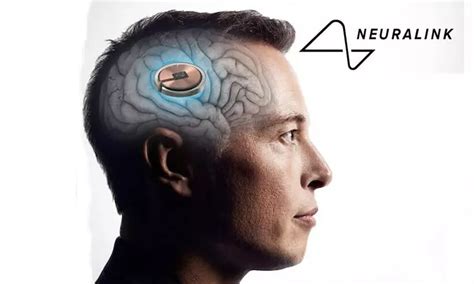 മനഷയ തലചചറൽ ചപപ ഘടപപചചളള പരകഷണതതന മസകന അനമത നൽക എഫഡഎ Neuralink