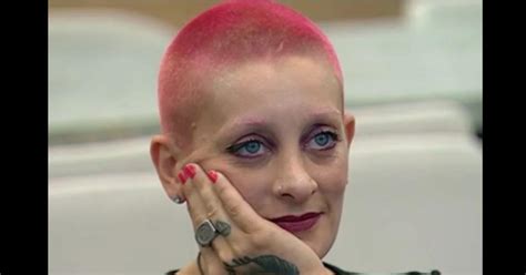 Qué Es La Leucemia Estadío 1 La Que Tiene Furia De Gran Hermano Es