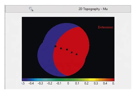 The Erders Topographical View Of The Mu And Beta Frequencies During
