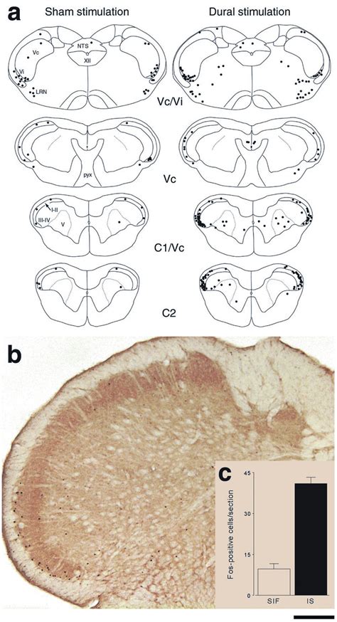 Noxious Stimulation Of The Dura Activates Fos Expression In The Spv
