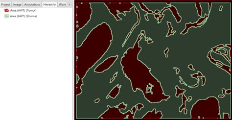 Guide Qupath Multiplex Analysis Workflow Detailed Pre 020 Release Image Analysis Image