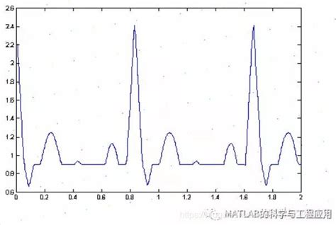 【源码】心电图ecg信号的matlab仿真 代码天地