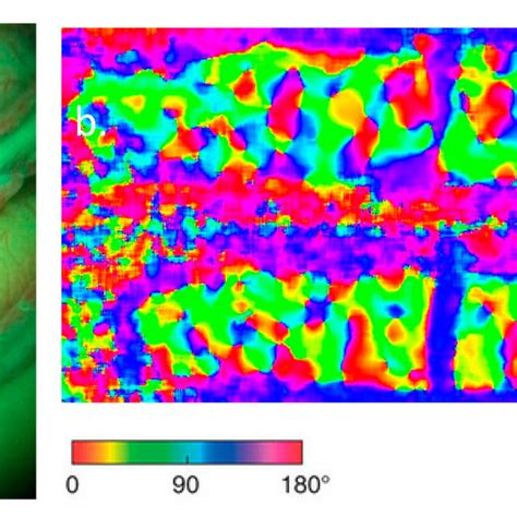 A Microscopy View Of The ECoG Electrode Positioned On The Cortical Download Scientific