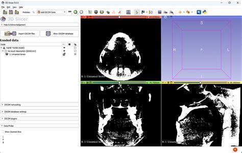 Bug 521 Data Is Loaded From Database But Doesnt Appear Under