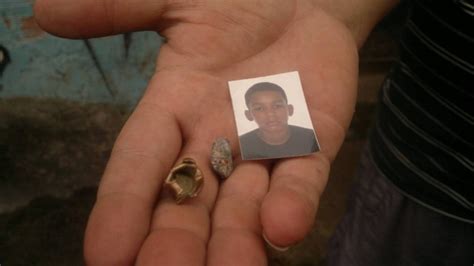 Rapaz Baleado No Alemão Tentará Identificar Policiais Da Upp Por Foto
