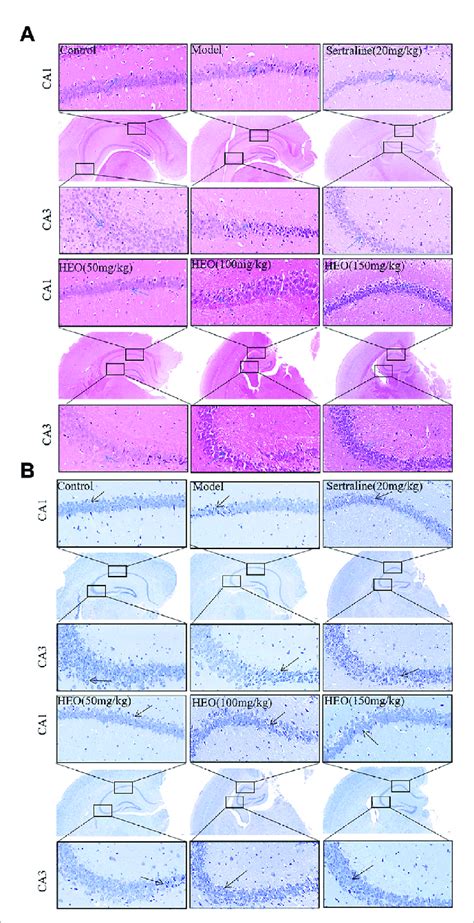 Histological Analysis And Nissl Staining Analysis Of Hippocampal Ca1