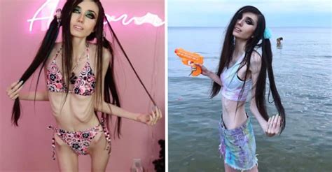 Eugenia Cooney Before And After Anorexia What Happened To Her