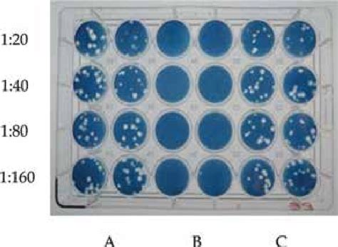 Plaque Reduction Neutralization Test For Denv 2 Using Bhk 21 Clone 15