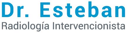 Embolización de miomas uterinos Dr Esteban