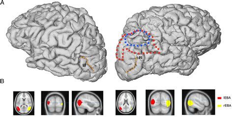 Multielectrode Array Recording Sites A Anatomical Utah Array