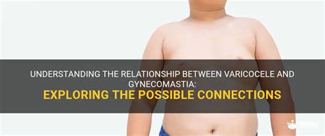 Understanding The Relationship Between Varicocele And Gynecomastia