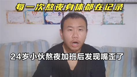 24岁小伙熬夜加班后发现嘴歪了每一次熬夜身体都在记录他的损伤 Youtube