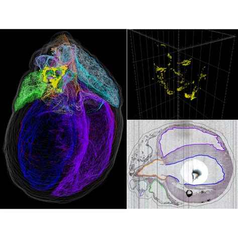 Single Cell Icn Neuron Mapping And D Heart Reconstruction With Tissue