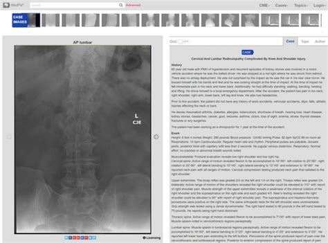 Pdf Cervical And Lumbar Radiculopathy Complicated By Knee And
