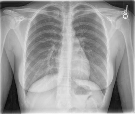 Chapter 2 Diagram Quizlet