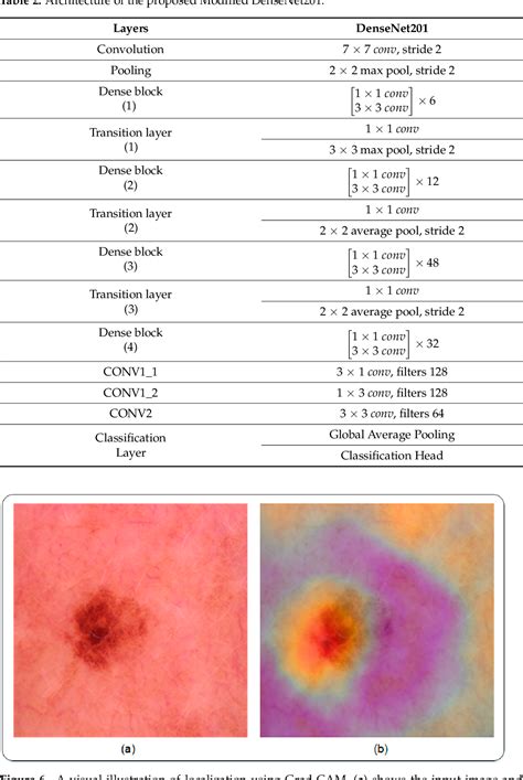 Table 2 From Classification Of Skin Cancer Lesions Using Explainable