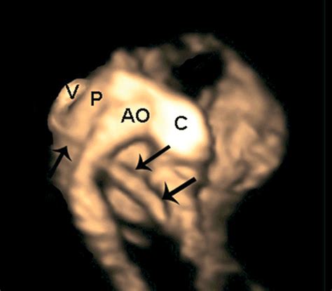 B Flow Spatiotemporal Image Correlation Image Showing The Spatial Download Scientific Diagram