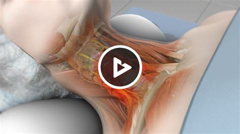 Anterior Cervical Discectomy And Fusion Acdf Neck Spine And Back