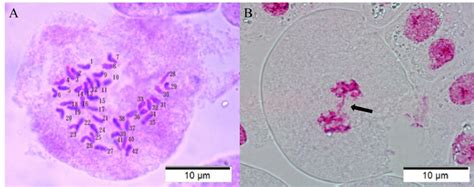 Chromosome Numbers In Root Tip Cells And Abnormal Male Meiosis In R Download Scientific