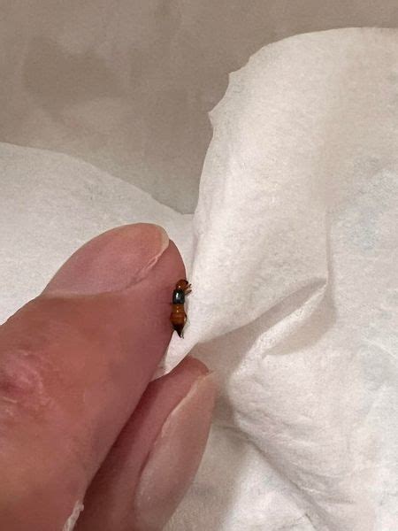 【昆蟲出沒】港男家中發現隱翅蟲 醫生：毒液具腐蝕性可致皮膚潰爛