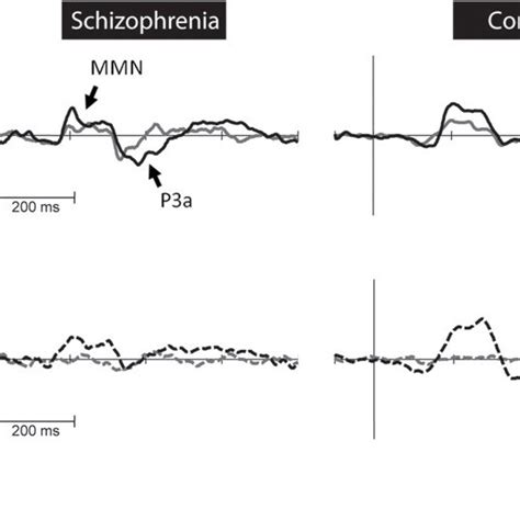 Mismatch Negativity Mmn Amplitudes To Emotional Syllables And