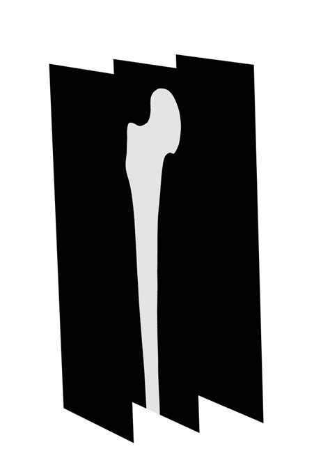 Generating A Simulation Mesh Of A Femur From 3d Data Comsol Blog