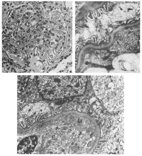Upper Left Photomicrograph Featuring A Representative Glomerulus