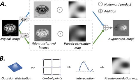 Causality Inspired Single Source Domain Generalization For Medical