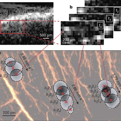 Pdf Ultrafast Ultrasound Localization Microscopy For Deep Super