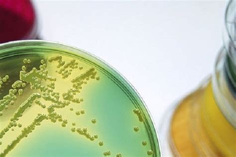 Maldi Tof Ms Quality Control In Clinical Microbiology