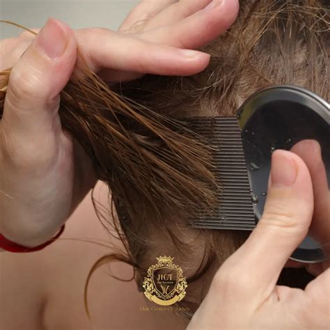 What Causes Head Lice How Does Hair Loss Affect