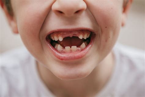 The Biblical Significance Of Teeth Falling Out In Dreams John Baptist