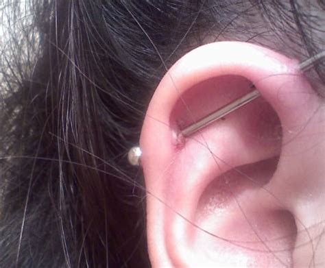 Helix Piercing Infection Symptoms Piercing Studio