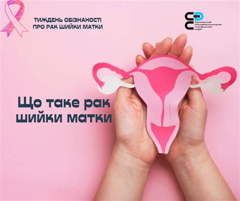 Що таке рак шийки матки ДУ Тернопільський обласний центр контролю