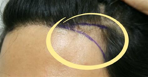 თავზე თმა არ გიჩერდებათ არსებობს მარტივი გადაწყვეტა და არა მხოლოდ ერთი სასარგებლო რჩევები